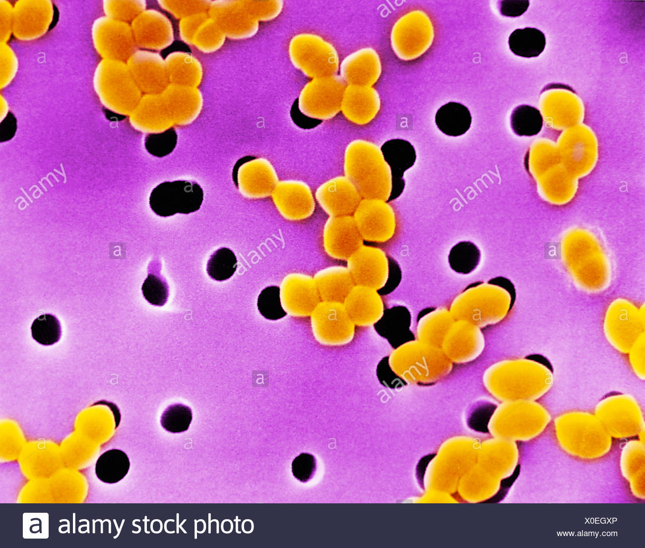 Enterococcus Faecalis High Resolution Stock Photography and Images - Alamy