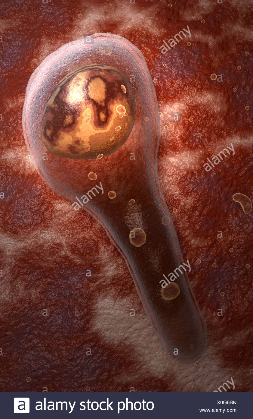 Clostridium Tetani High Resolution Stock Photography and Images - Alamy