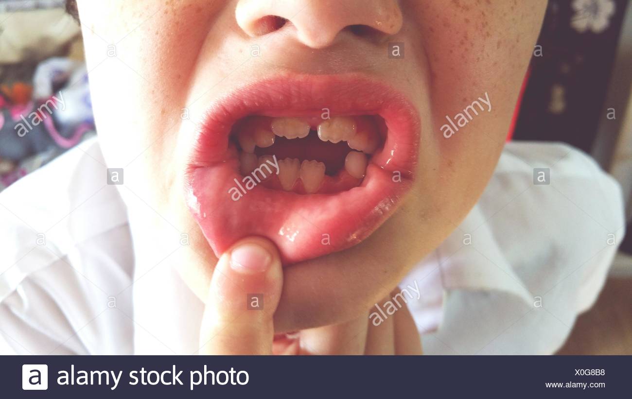 Real Teeth High Resolution Stock Photography and Images - Alamy