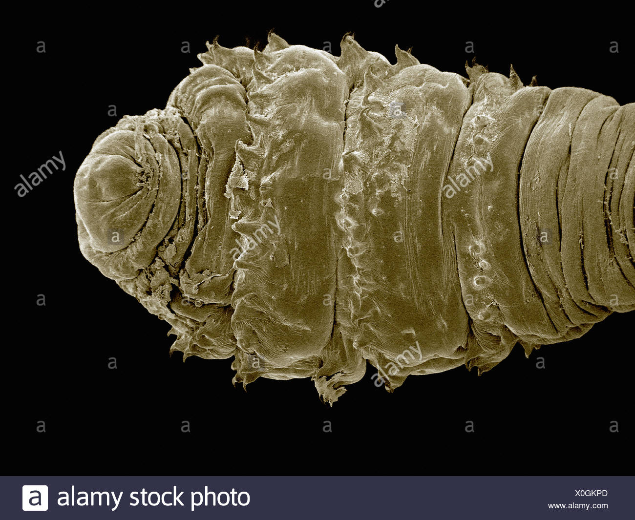 Human Botfly Stock Photos & Human Botfly Stock Images - Alamy