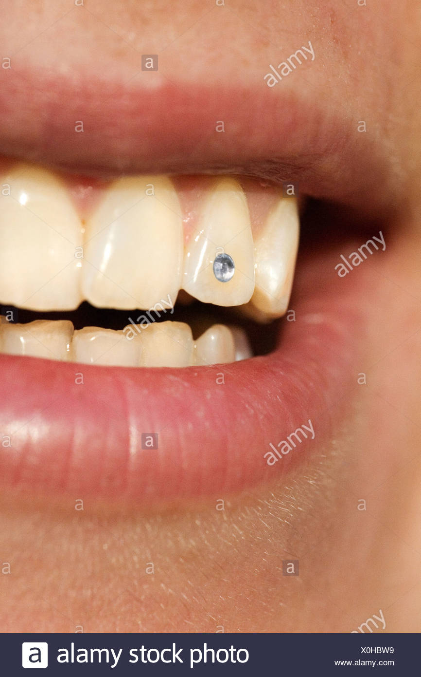 Diamond Teeth High Resolution Stock Photography and Images - Alamy