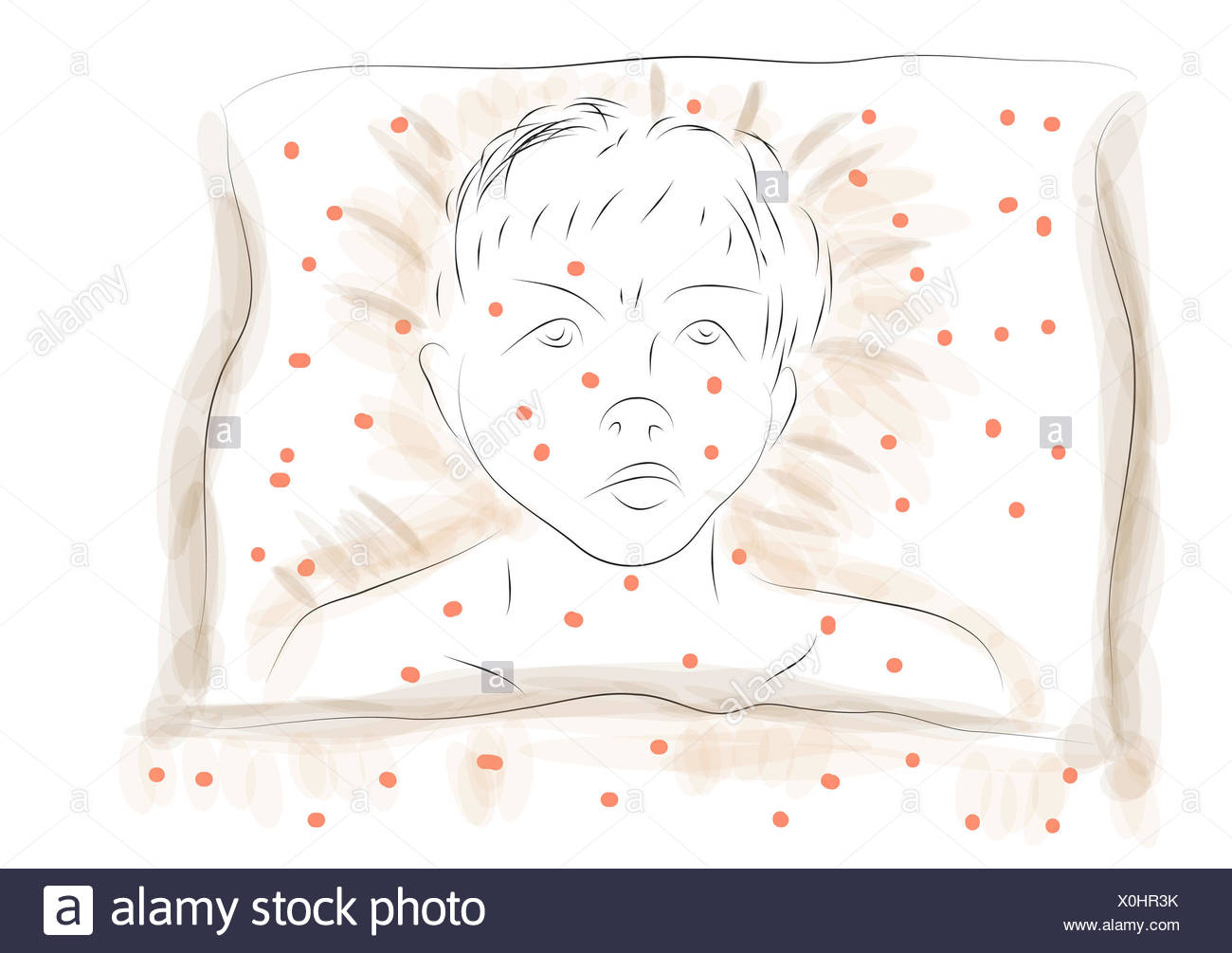 Measles Virus Illustration High Resolution Stock Photography and Images ...
