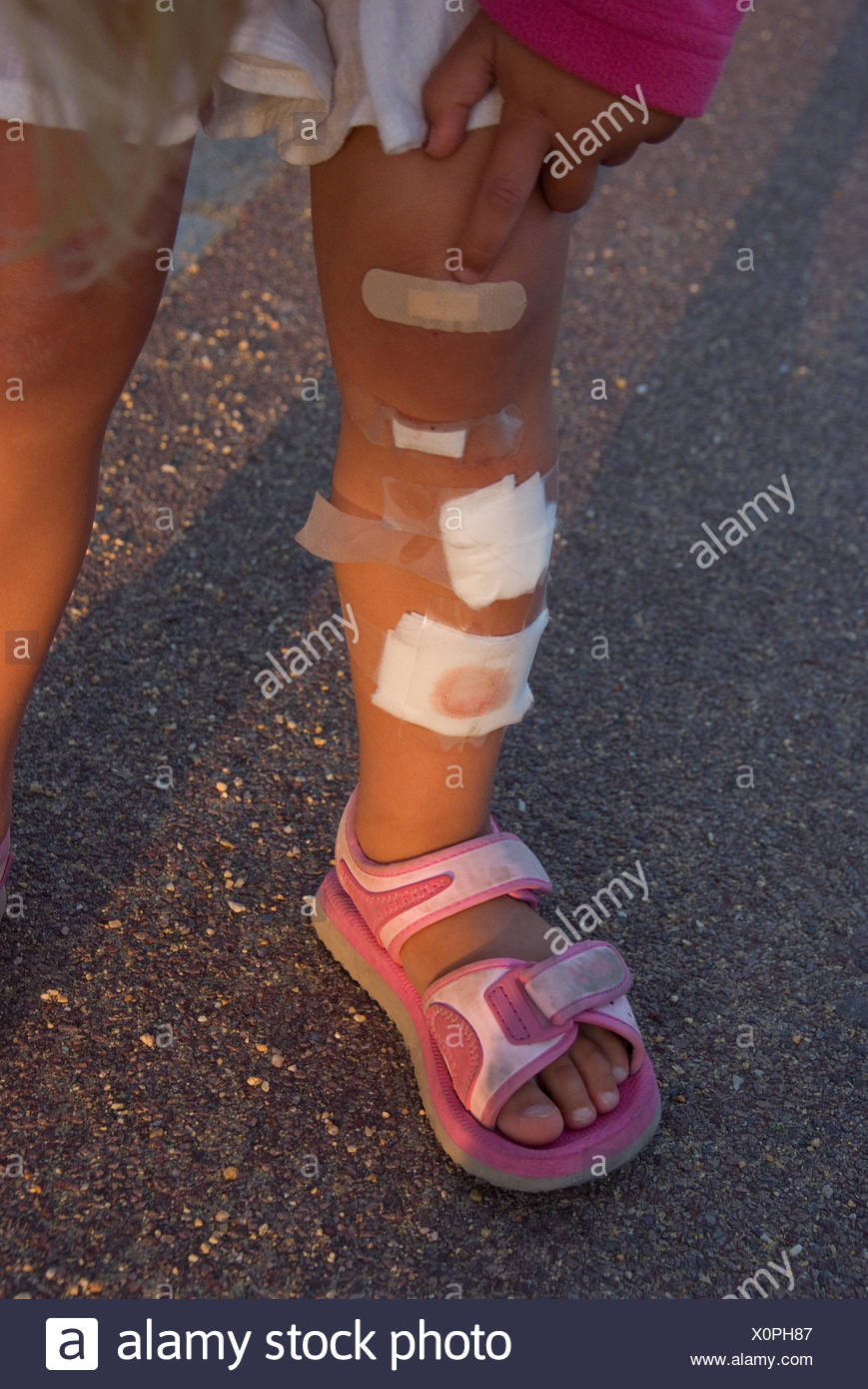 Gash Wound Stock Photos & Gash Wound Stock Images - Alamy