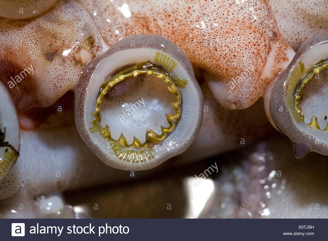 Suck Teeth High Resolution Stock Photography and Images - Alamy