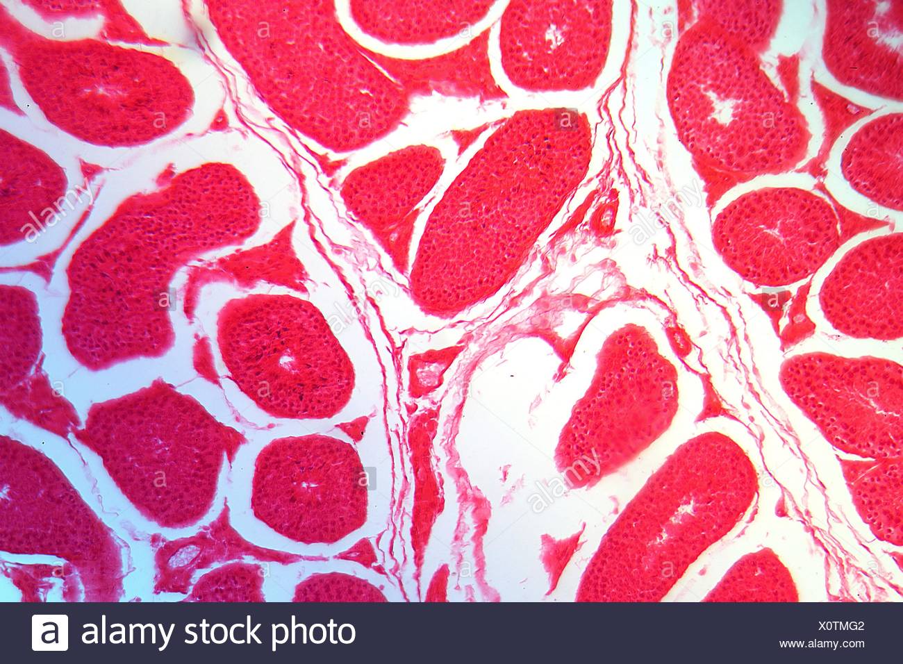Human Testicle High Resolution Stock Photography and Images - Alamy