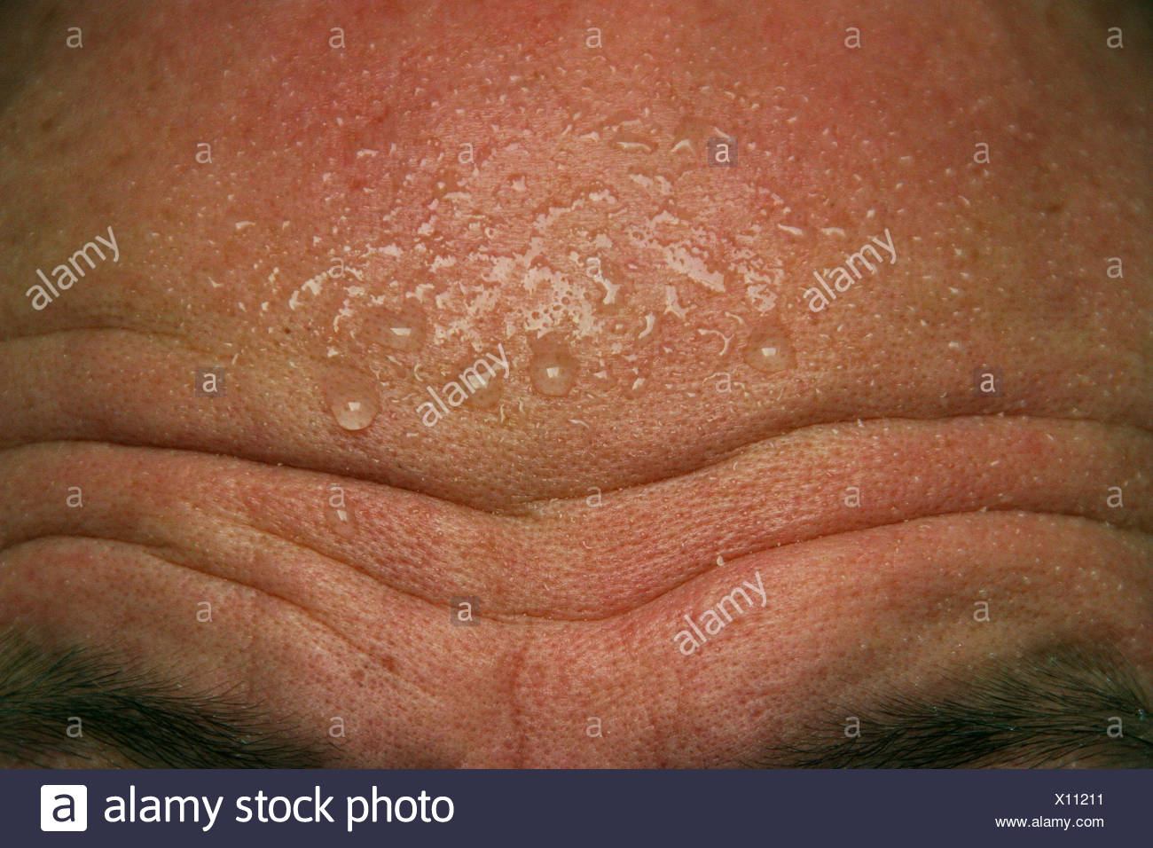 Forehead Wrinkles Stock Photos & Forehead Wrinkles Stock Images - Alamy