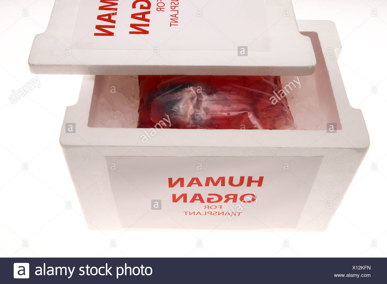 Organ Transplantation Box High Resolution Stock Photography and Images ...