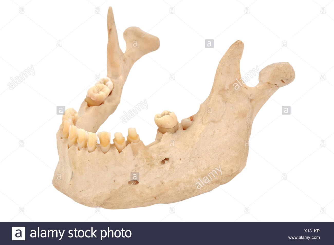Upper Jaw Bone High Resolution Stock Photography and Images - Alamy