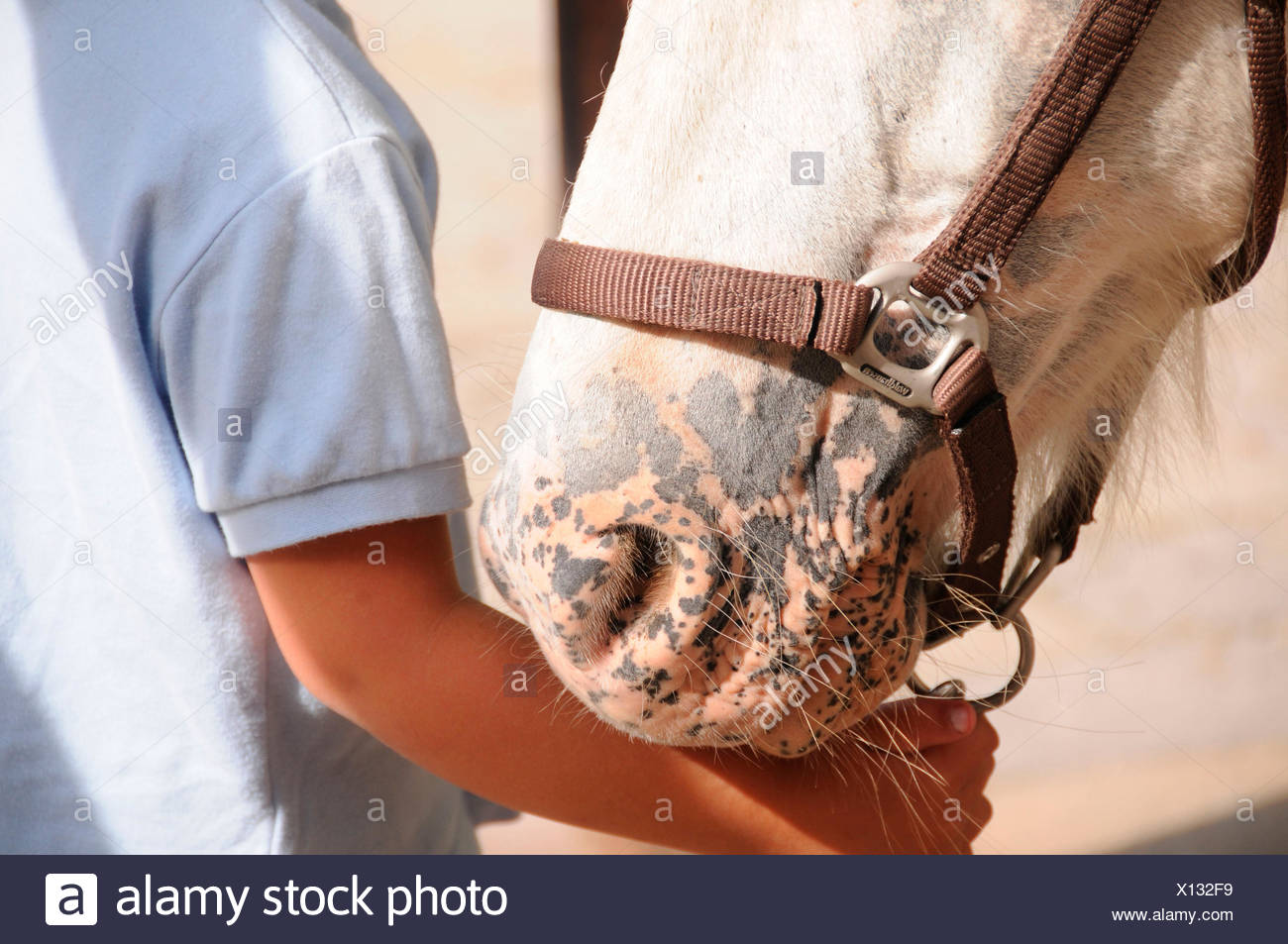 Mottled Skin High Resolution Stock Photography and Images - Alamy