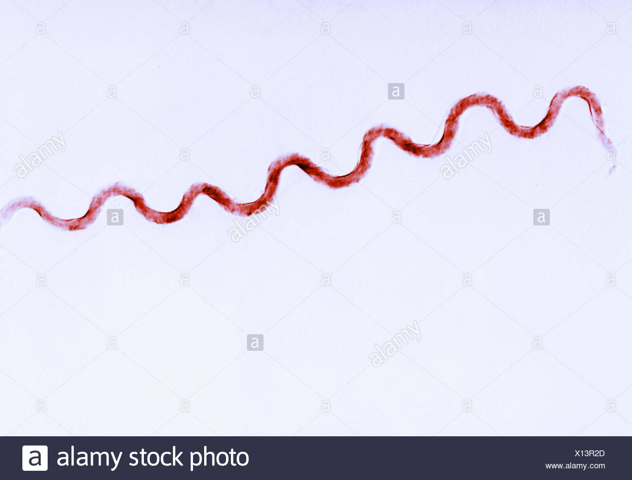 Treponema Pallidum High Resolution Stock Photography and Images - Alamy