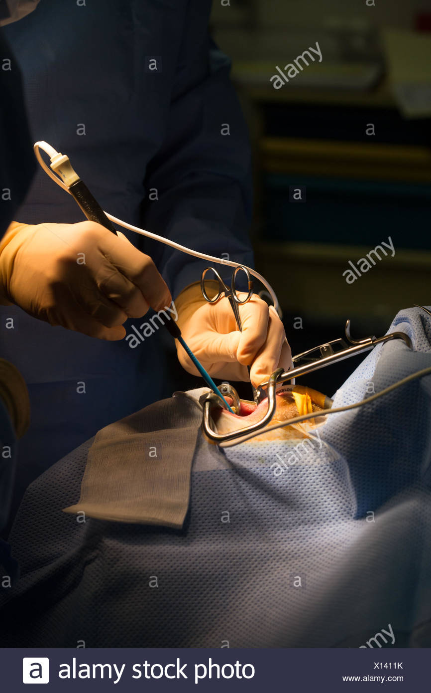 Tonsil Surgery High Resolution Stock Photography and Images - Alamy
