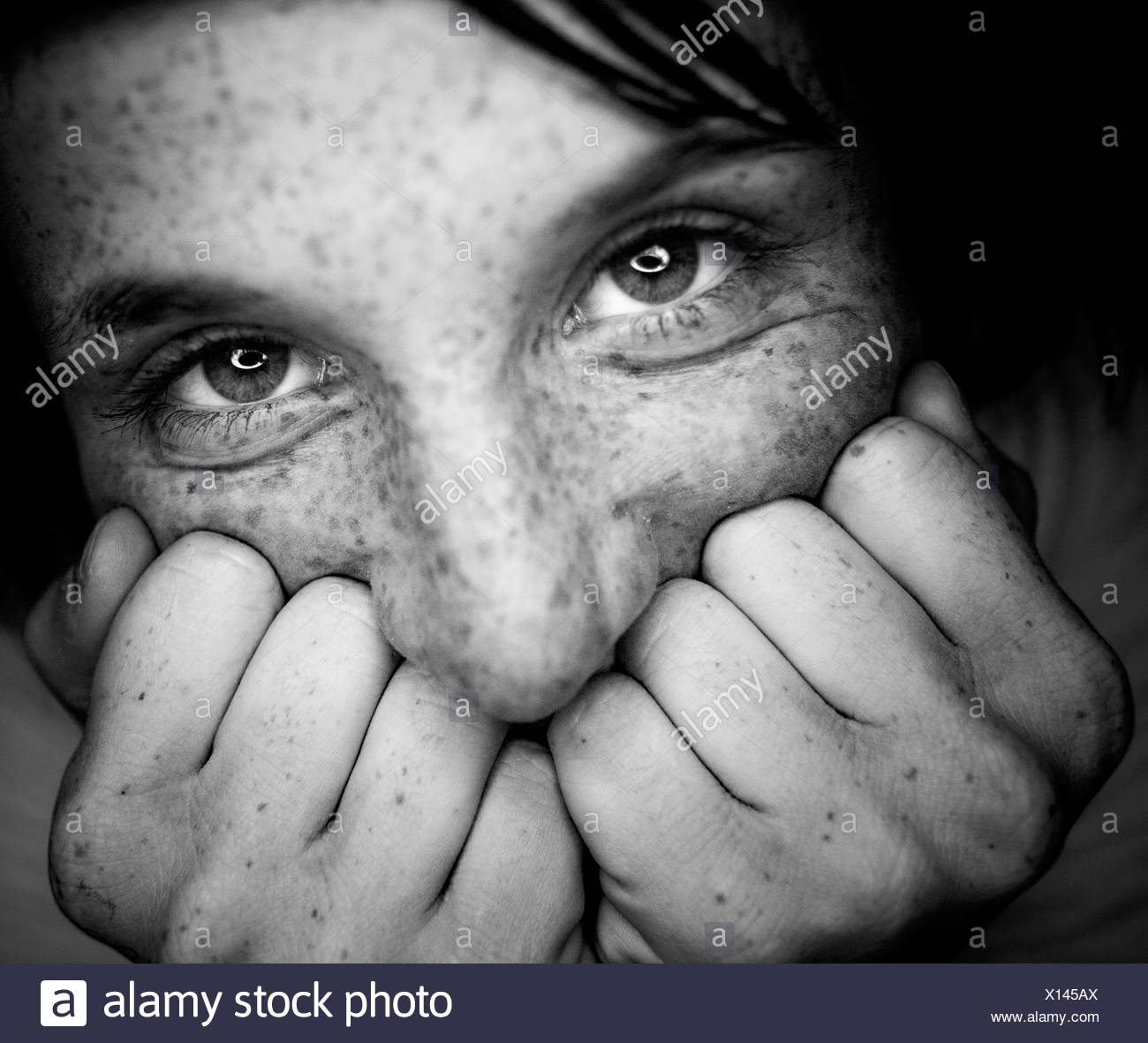 Freckled Face High Resolution Stock Photography and Images - Alamy