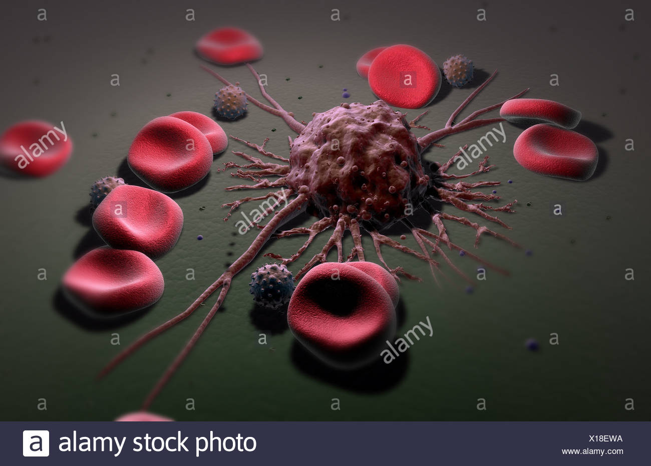 The Metastasis High Resolution Stock Photography and Images - Alamy