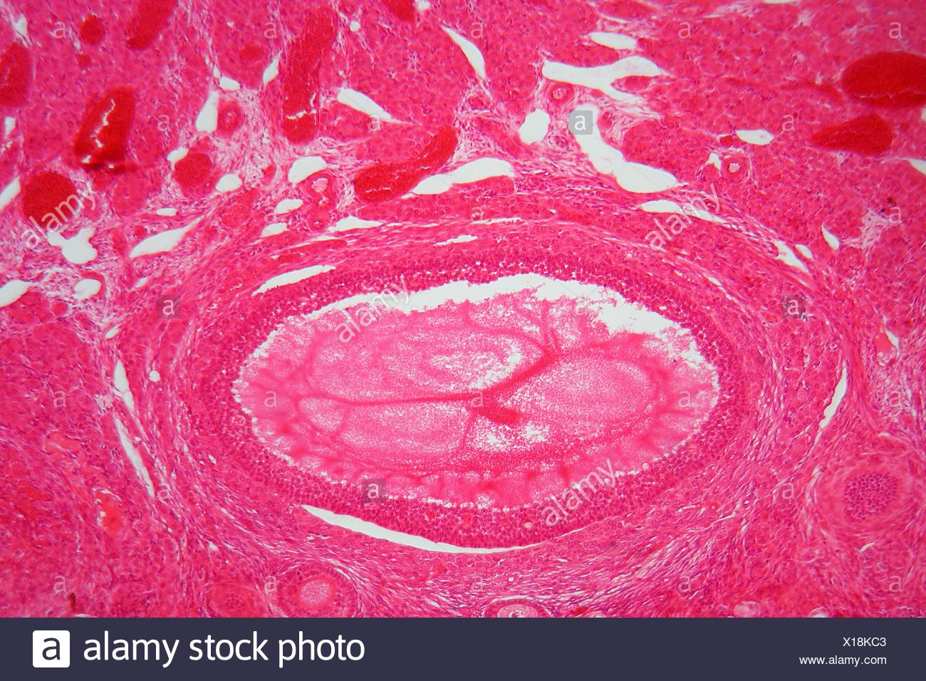 Ovary Micrograph High Resolution Stock Photography and Images - Alamy