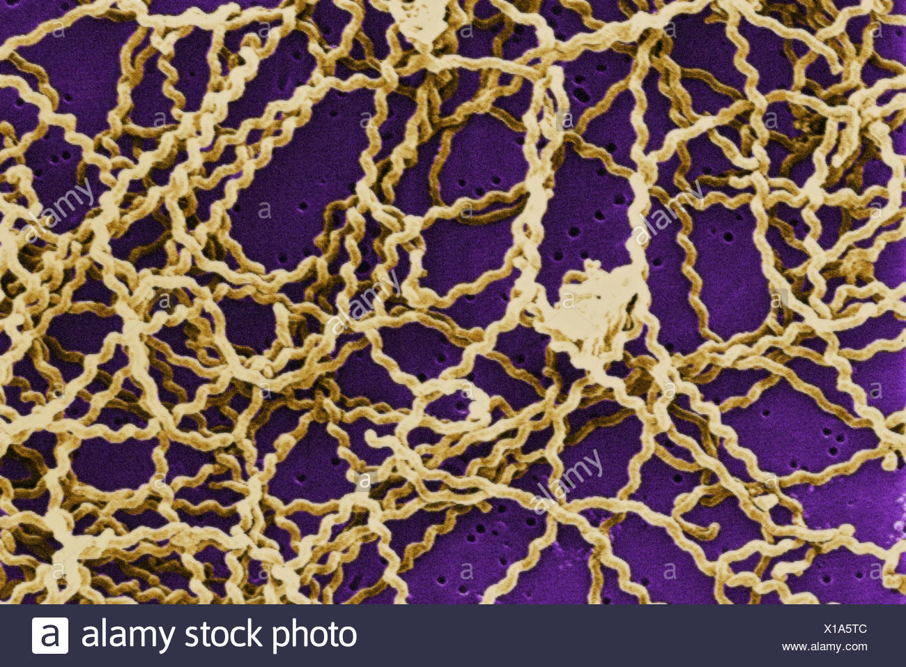 Leptospira Bacteria High Resolution Stock Photography and Images - Alamy