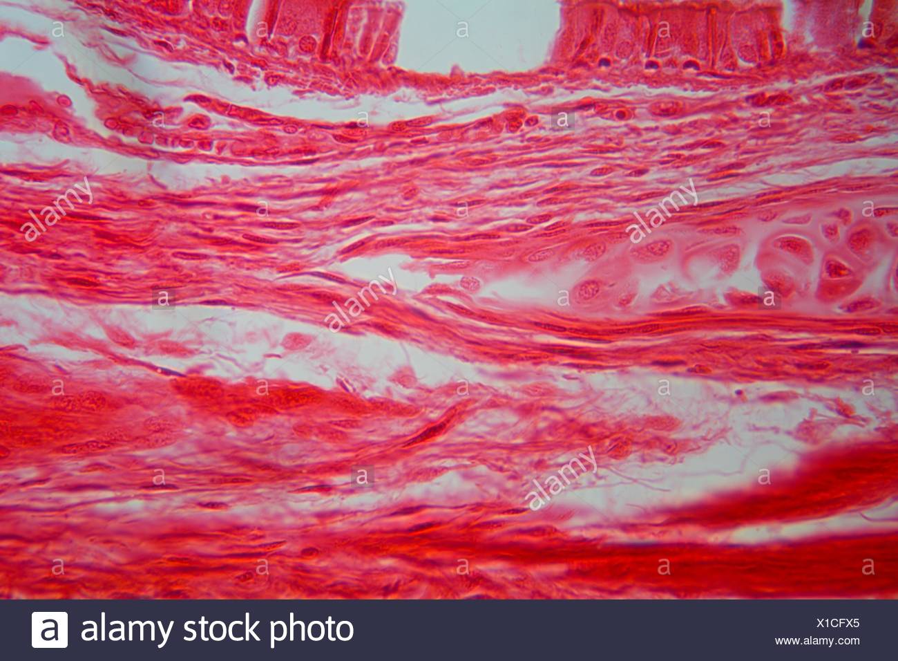 Trachea Micrograph High Resolution Stock Photography and Images - Alamy