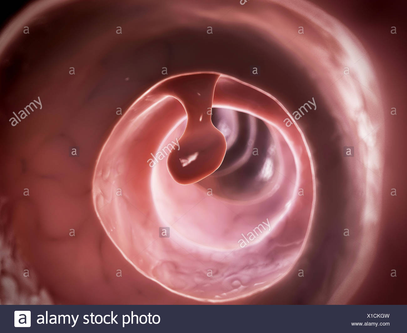 Ct Of Colon High Resolution Stock Photography and Images - Alamy
