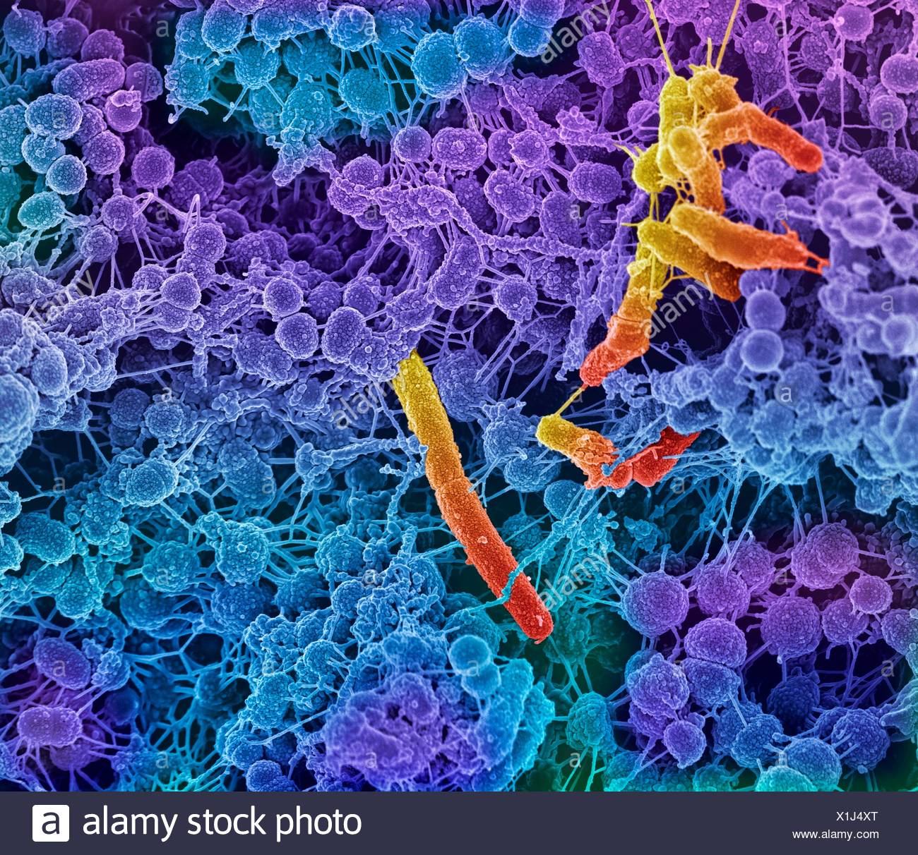 Oral Bacteria High Resolution Stock Photography and Images - Alamy