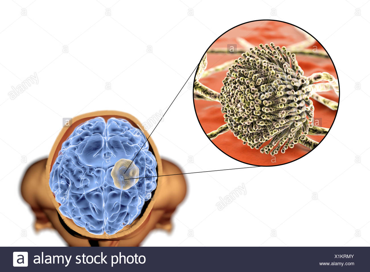 Fungus Aspergillus High Resolution Stock Photography and Images - Alamy