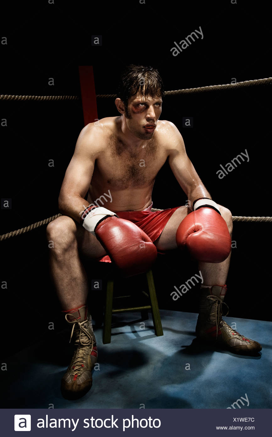 Chest Bruise Stock Photos & Chest Bruise Stock Images - Alamy