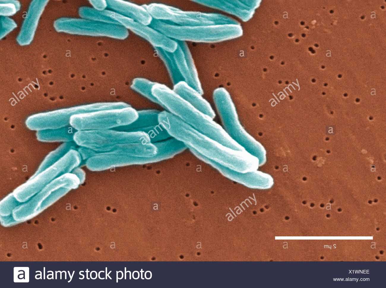 Mycobacterium Tuberculosis Stock Photos & Mycobacterium Tuberculosis Stock Images - Alamy