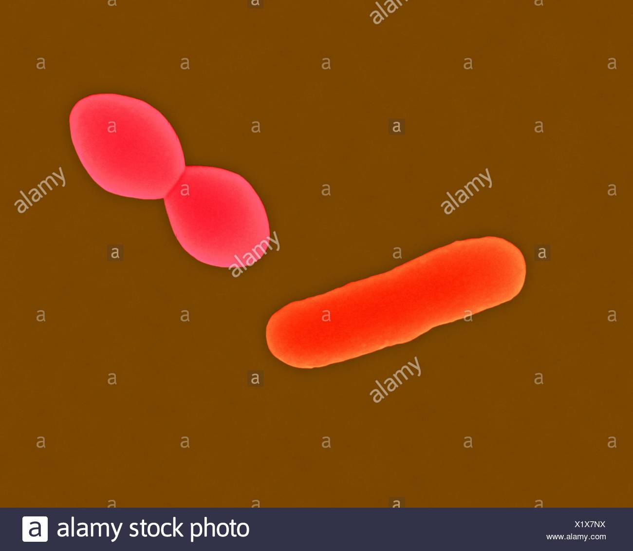 Streptococcus Pneumoniae Gram High Resolution Stock Photography and ...