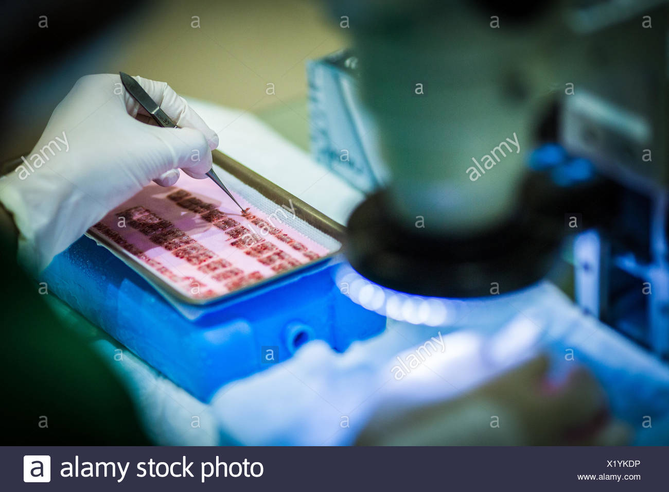 Follicle Procedure High Resolution Stock Photography and Images - Alamy