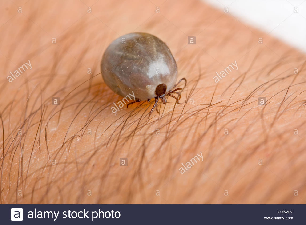Human Itch Mite High Resolution Stock Photography and Images - Alamy