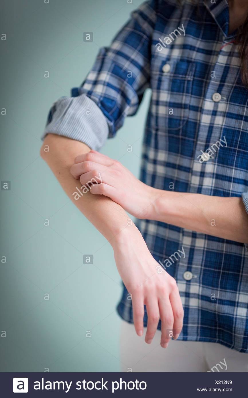 Scratching Arm Stock Photos & Scratching Arm Stock Images - Alamy