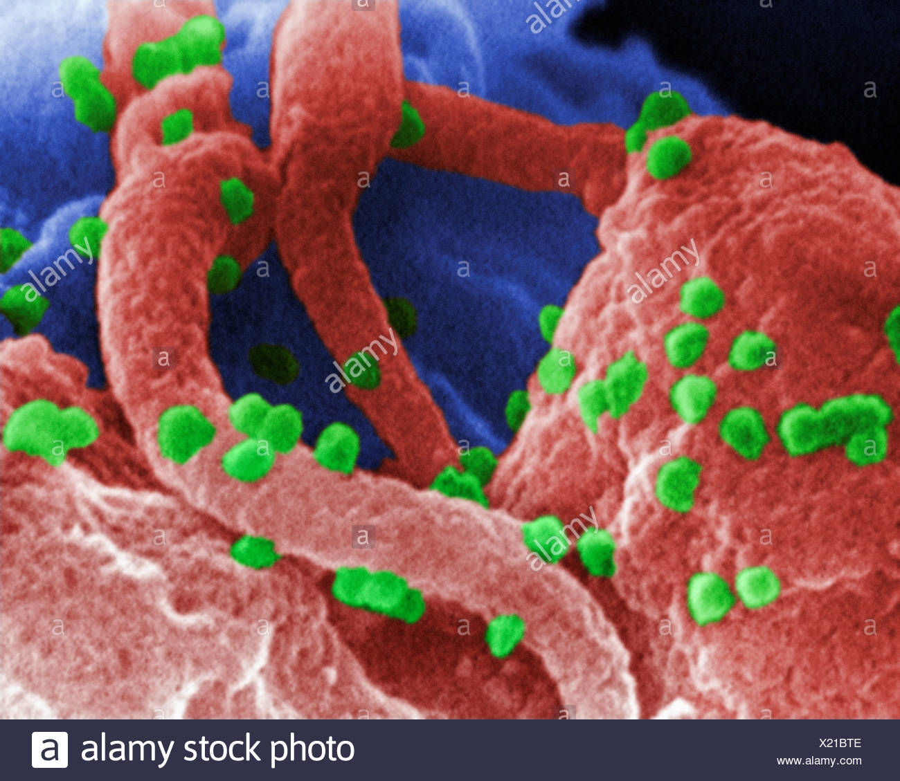 Scanning Electron Micrograph Of Hiv 1 High Resolution Stock Photography ...
