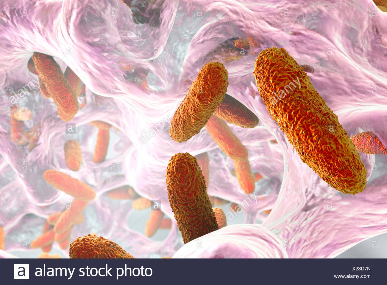 Klebsiella Pneumoniae Stock Photos & Klebsiella Pneumoniae Stock Images ...