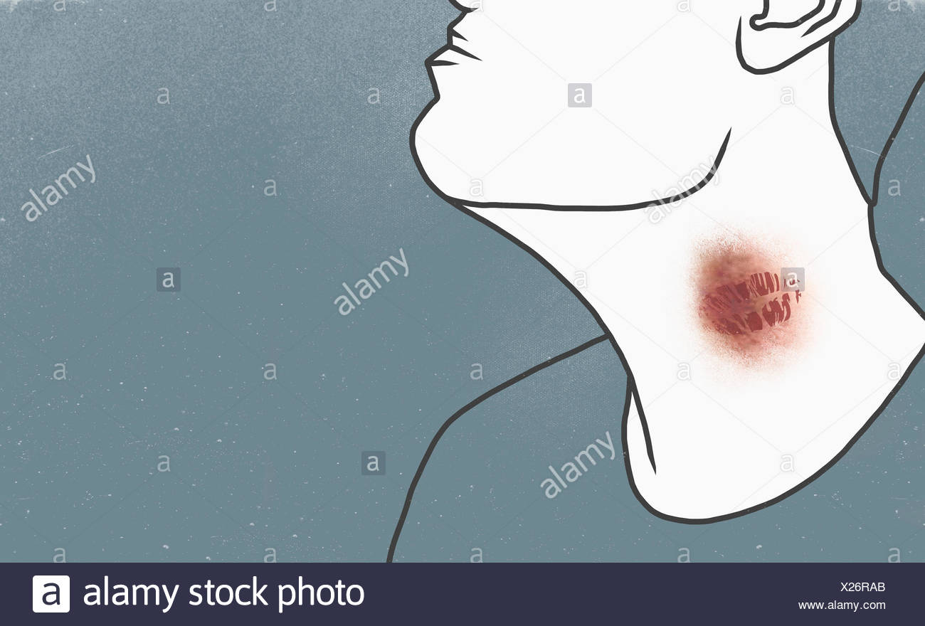 Love Bite And Neck High Resolution Stock Photography and Images - Alamy
