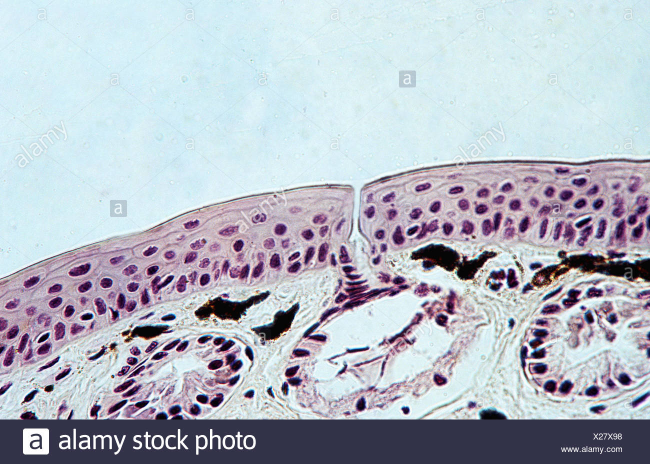 Skin Histology Stock Photos & Skin Histology Stock Images - Alamy