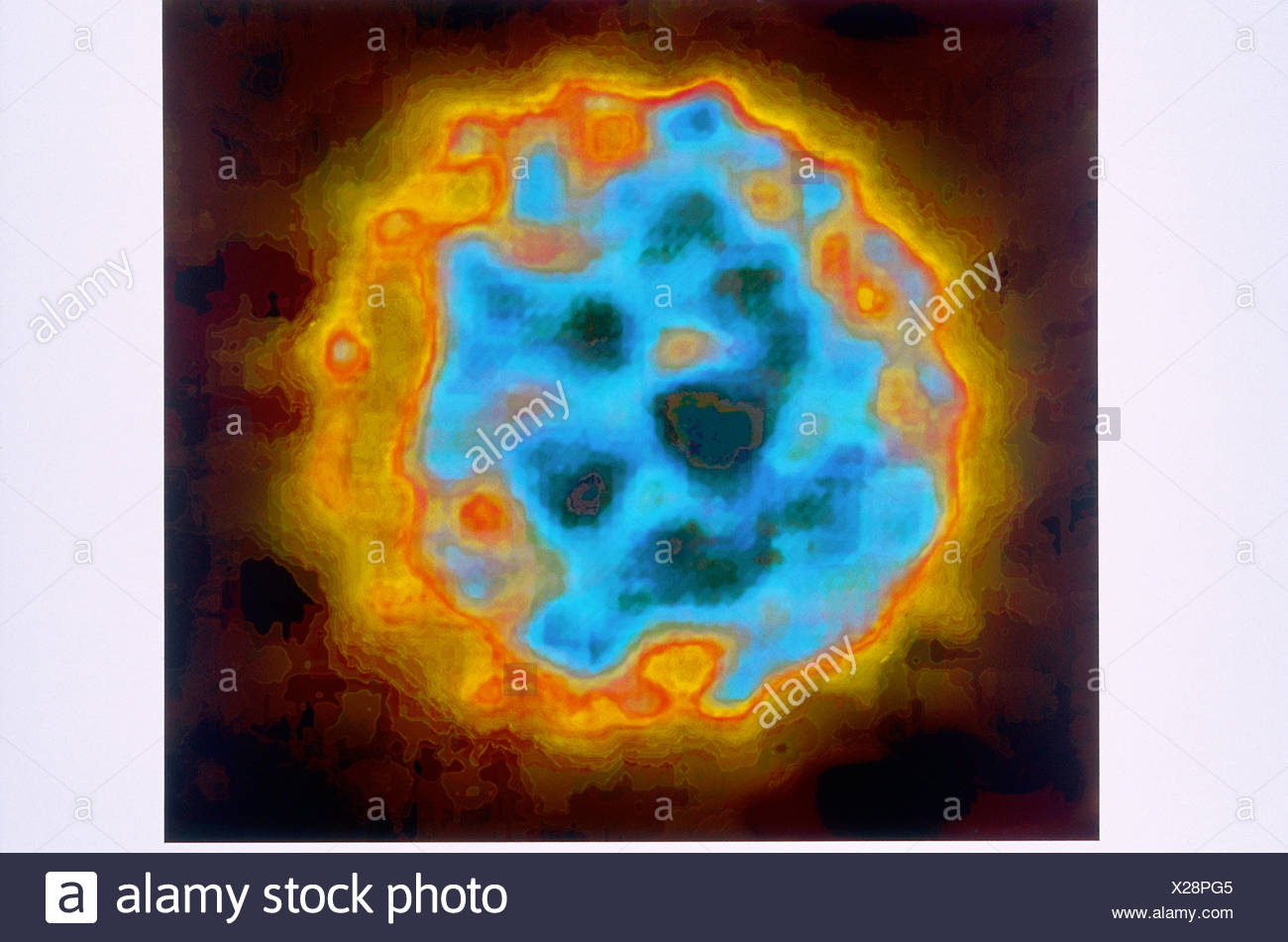 Papovavirus High Resolution Stock Photography and Images - Alamy