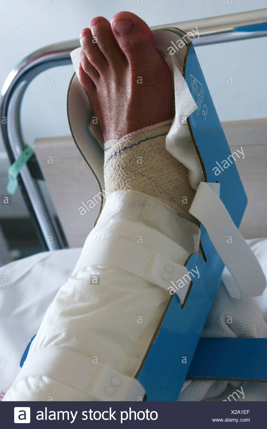 Fractures Of The Leg High Resolution Stock Photography and Images - Alamy