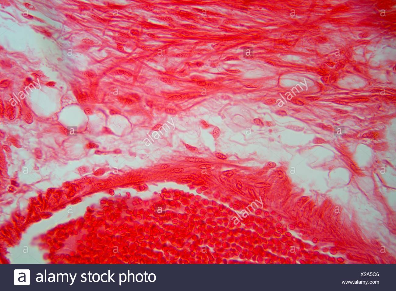 Trachea Micrograph High Resolution Stock Photography and Images - Alamy