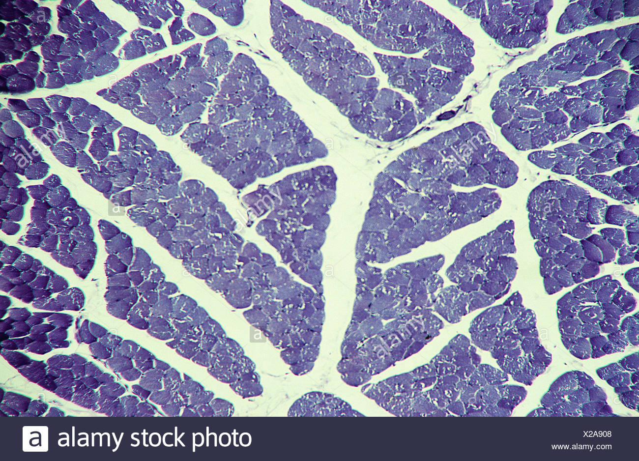 Skeletal Striated Muscle Stock Photos & Skeletal Striated Muscle Stock ...