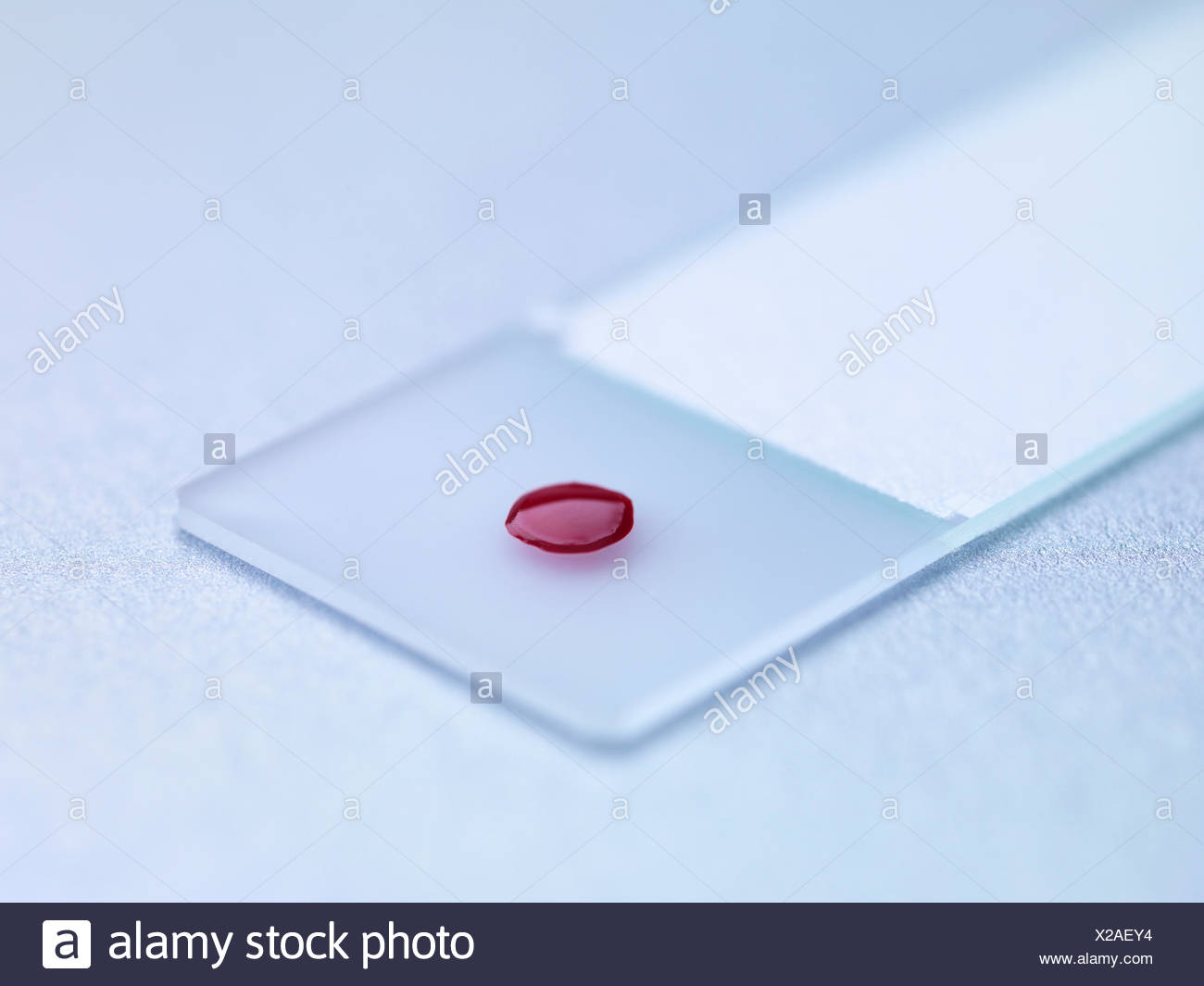 Blood Cell Microscope Stock Photos & Blood Cell Microscope Stock Images ...