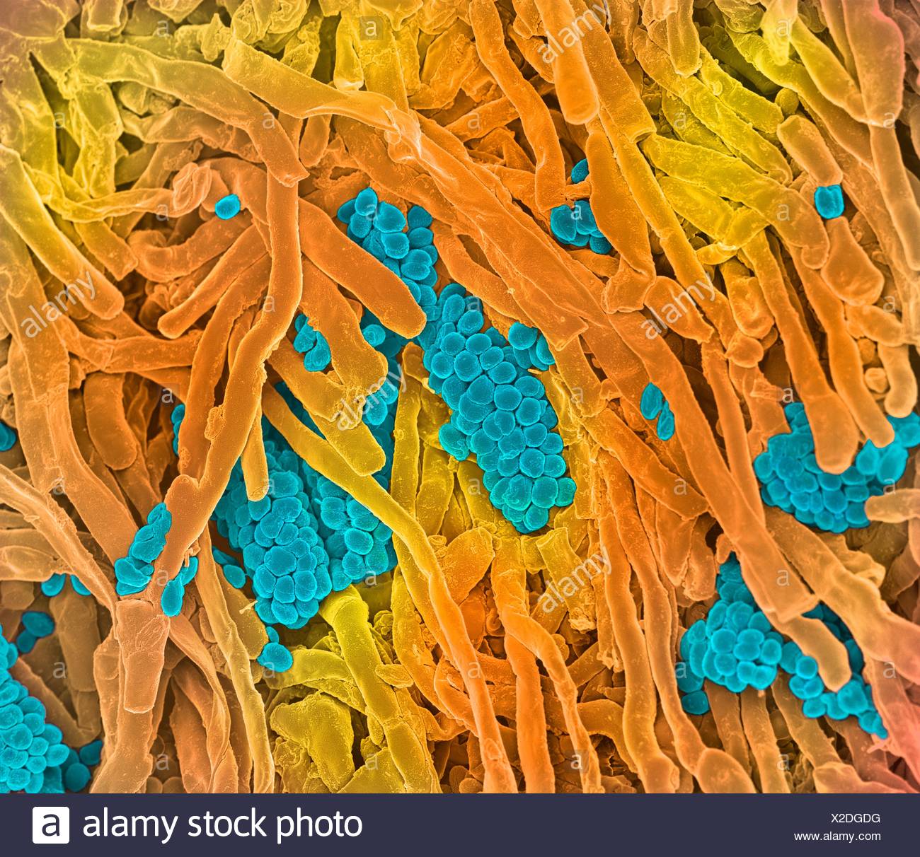 Streptomyces High Resolution Stock Photography and Images - Alamy