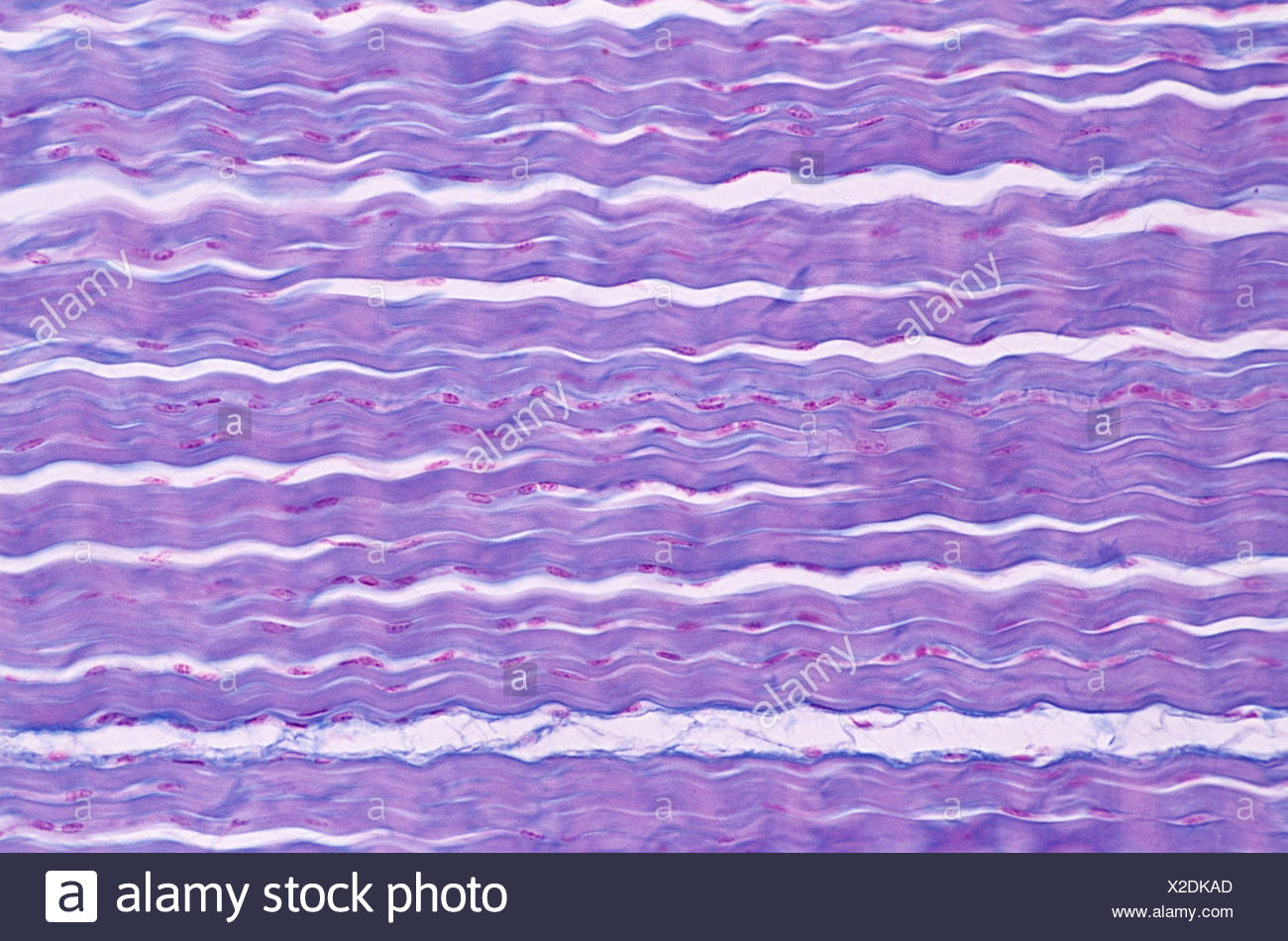Cross Section Muscle Tissue High Resolution Stock Photography and ...