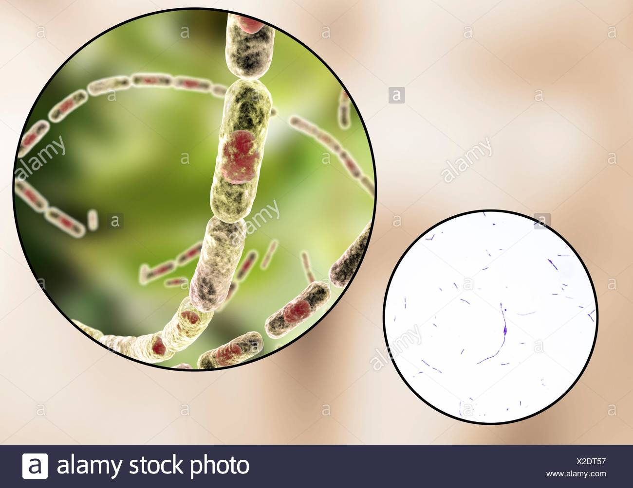 Anthrax Spore High Resolution Stock Photography and Images - Alamy