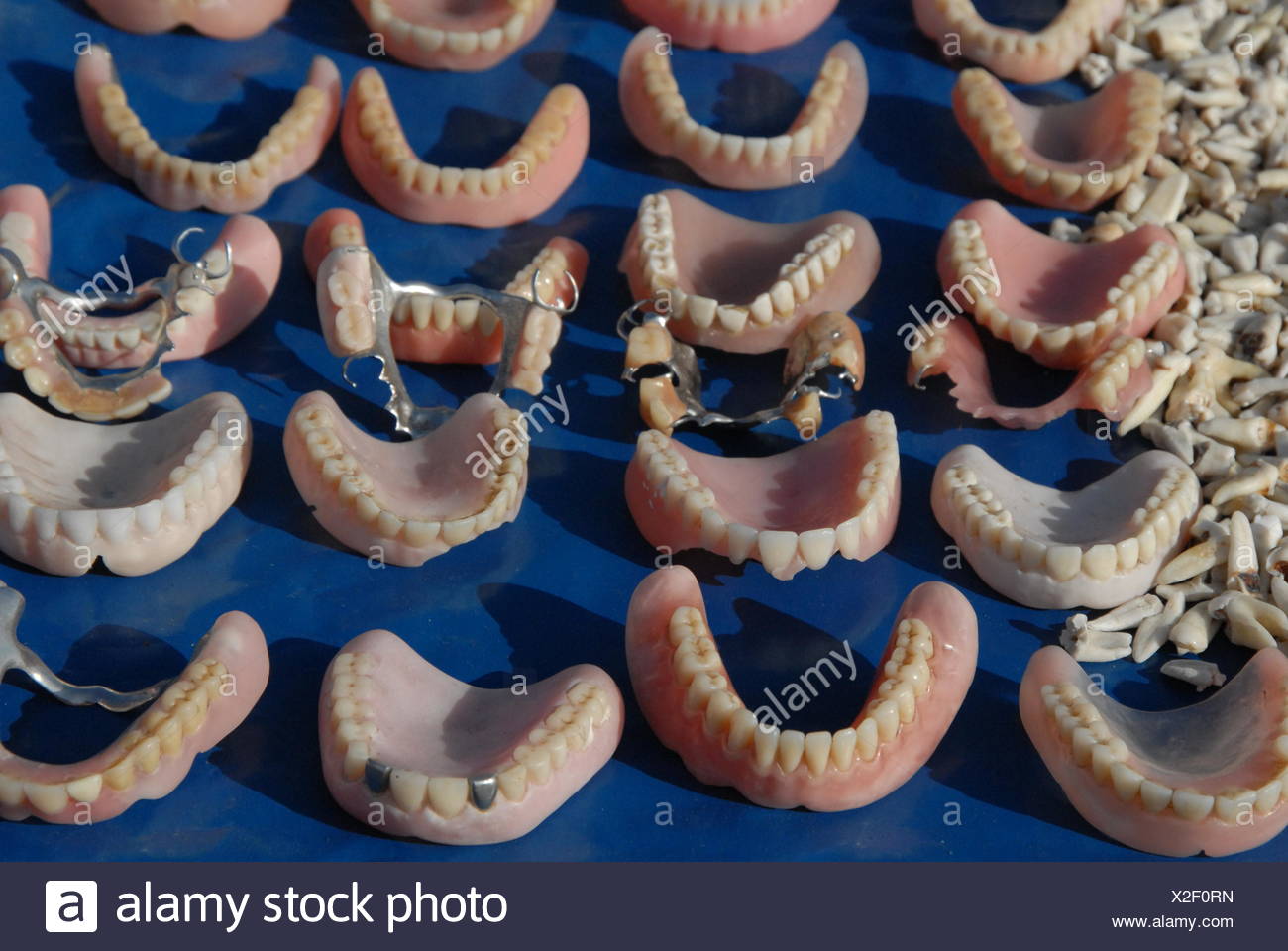 Gold Teeth Denture High Resolution Stock Photography and Images - Alamy