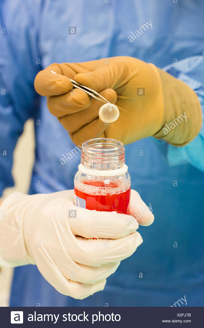 Corneal Grafting Procedure High Resolution Stock Photography and Images ...