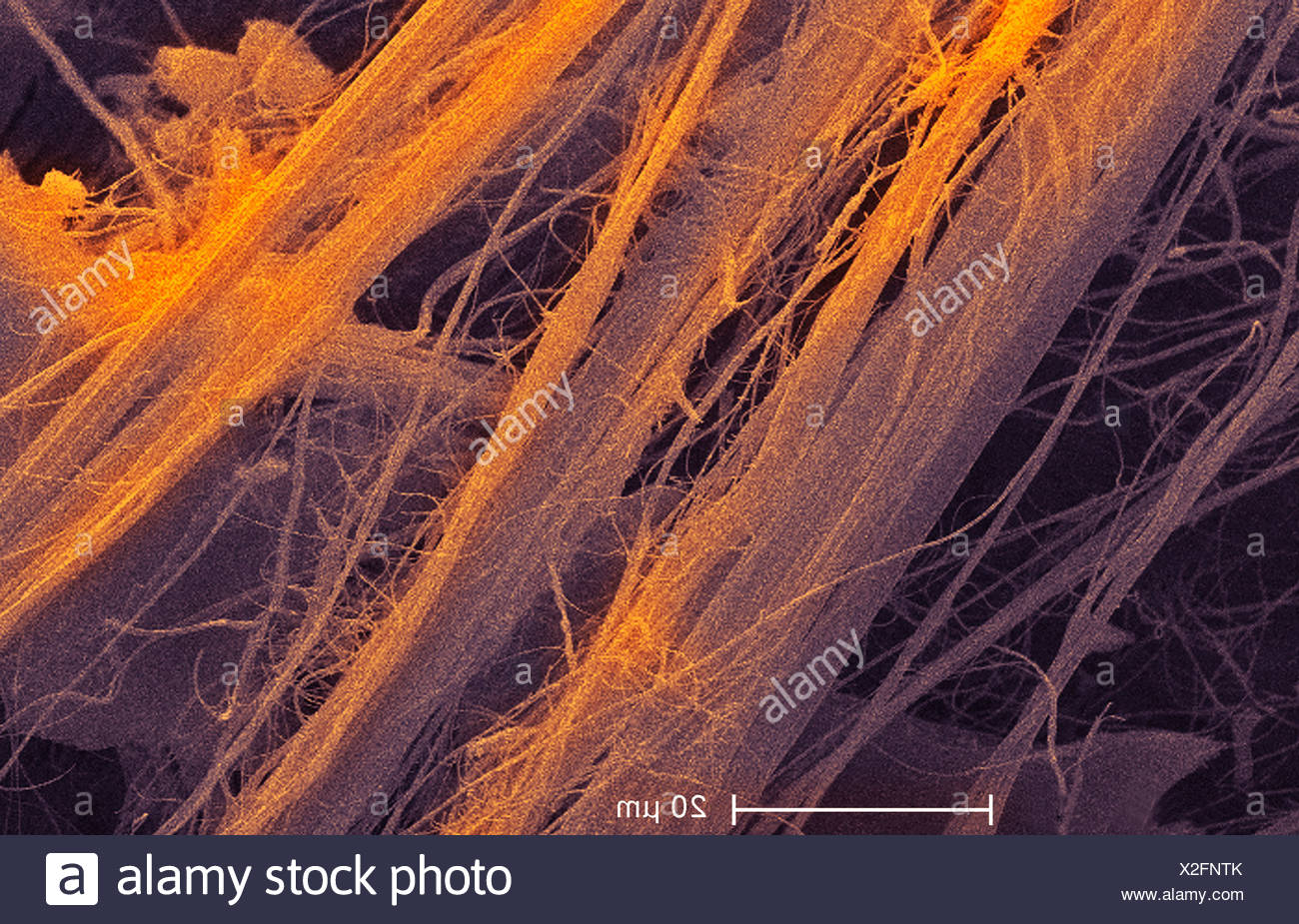 Scanning Electron Micrograph Asbestos High Resolution Stock Photography ...