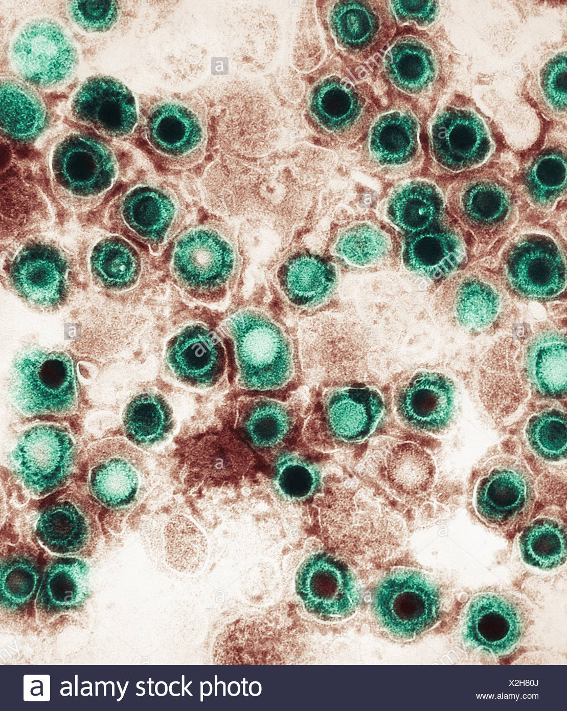 Herpes Virus Micrograph High Resolution Stock Photography and Images ...