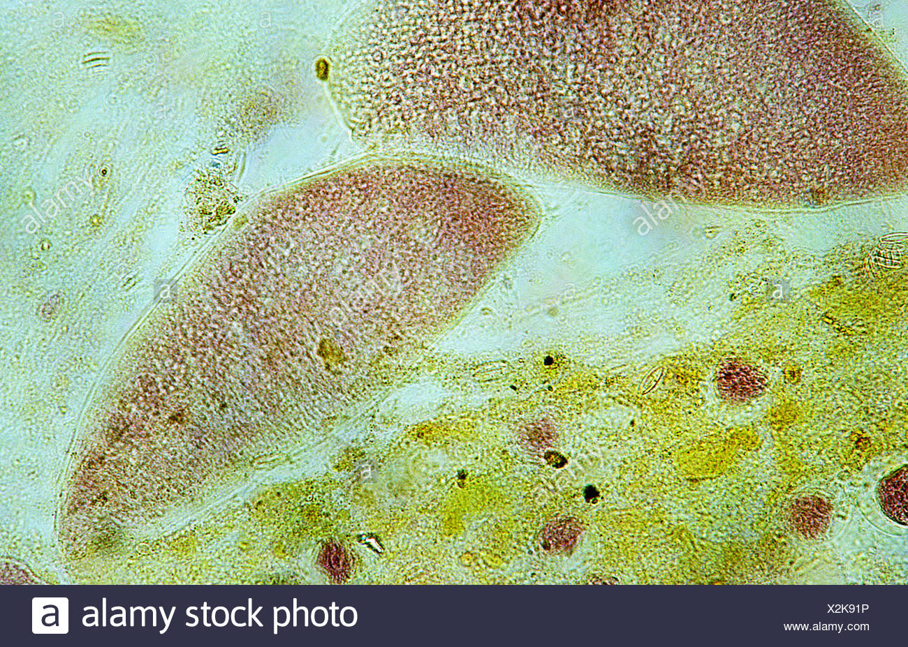 Protozoa Parasite High Resolution Stock Photography and Images - Alamy