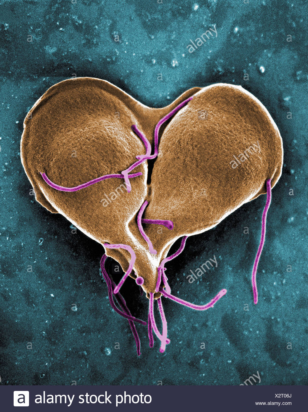 Giardiasis Protozoan Giardia Lamblia Stock Photos & Giardiasis ...