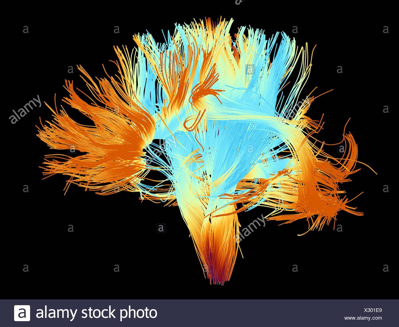 Brain Mapping High Resolution Stock Photography and Images - Alamy