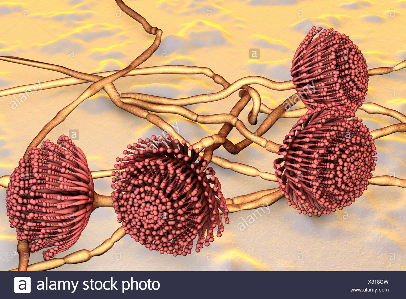 Ear Disorders High Resolution Stock Photography and Images - Alamy