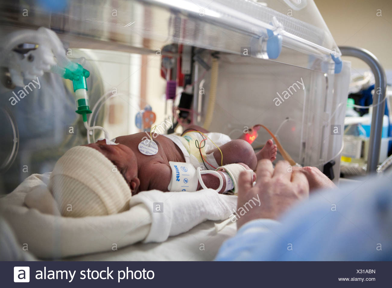 Pediatric Icu High Resolution Stock Photography and Images - Alamy